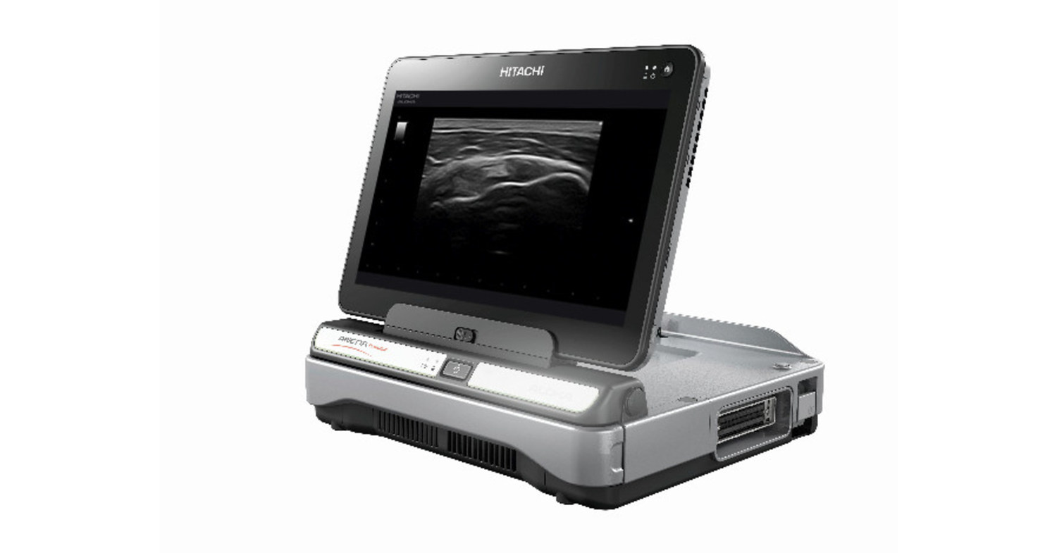Hitachi Medical Systems Europe Announces "ScanSync" - a New Function ...