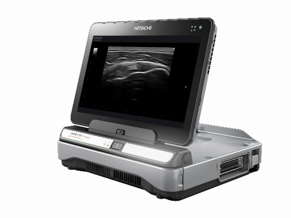 Hitachi Medical Systems Europe Announces "ScanSync" - a New Function ...
