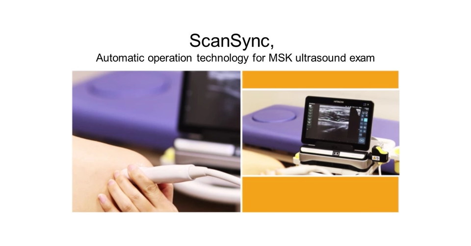 Hitachi Medical Systems Europe Announces "ScanSync" - a New Function ...