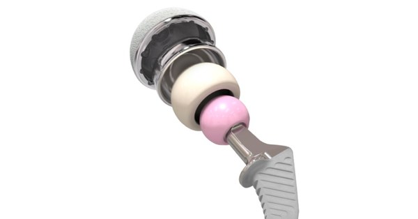 Corin Group Launches Trinity™ Dual Mobility System for Hip Replacement ...
