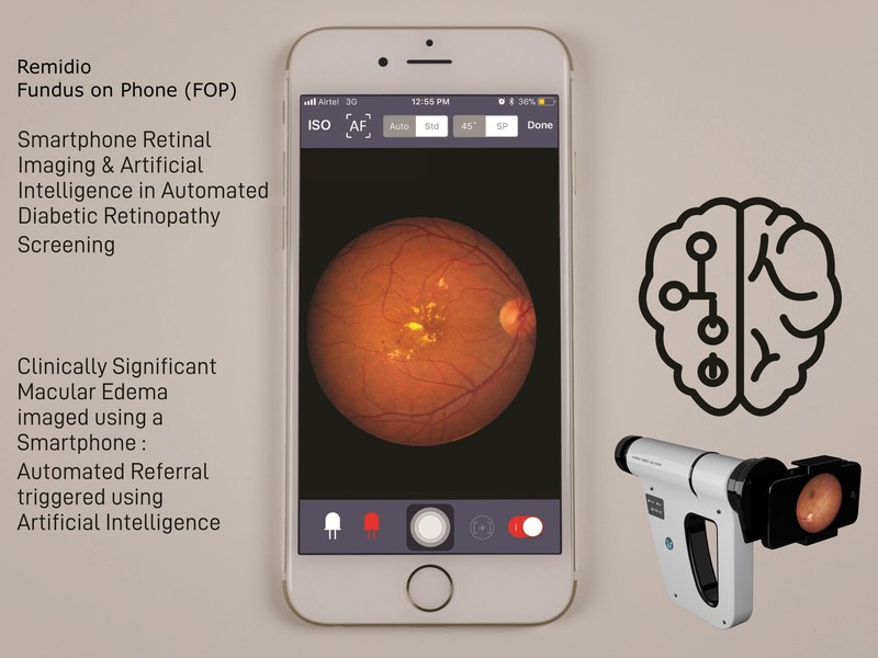 Smartphone-based Retinal Imaging Together With Artificial Intelligence ...