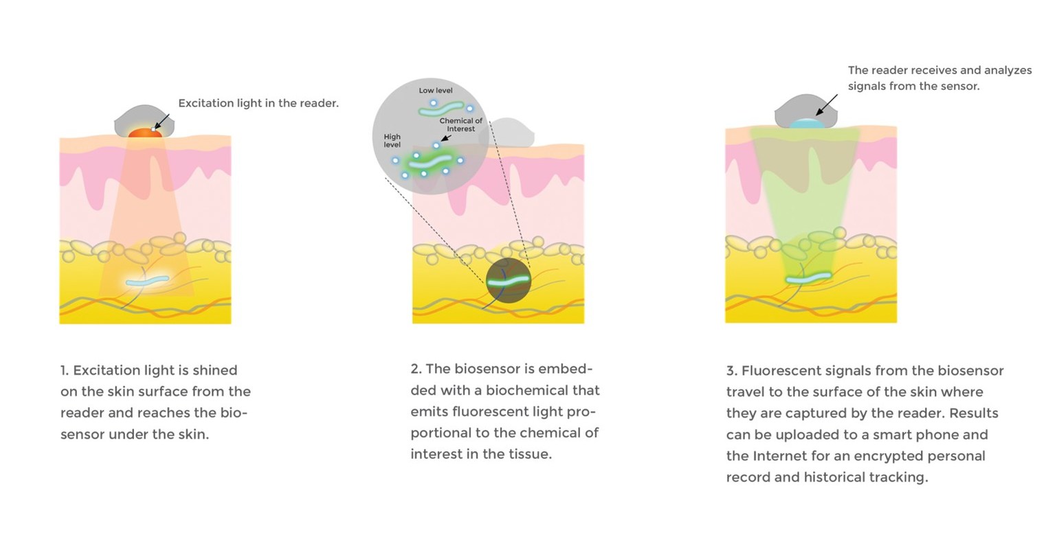Injectable Body Sensors Take Personal Chemistry to a Cell Phone Closer ...