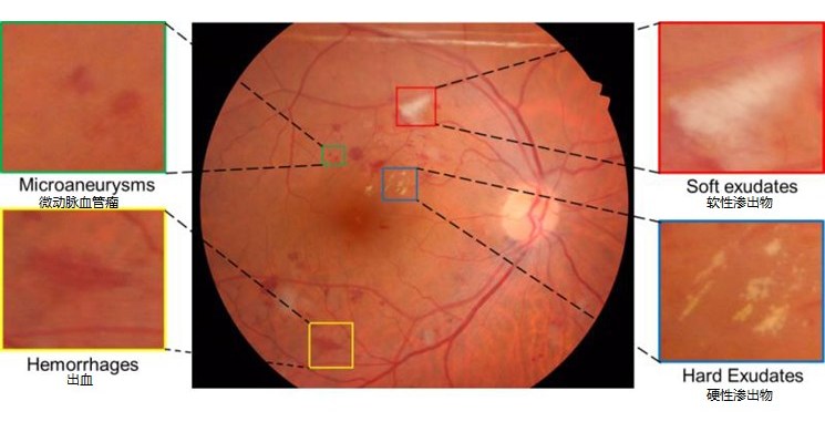 Ping An Technology again wins world-class award in medical field after ...