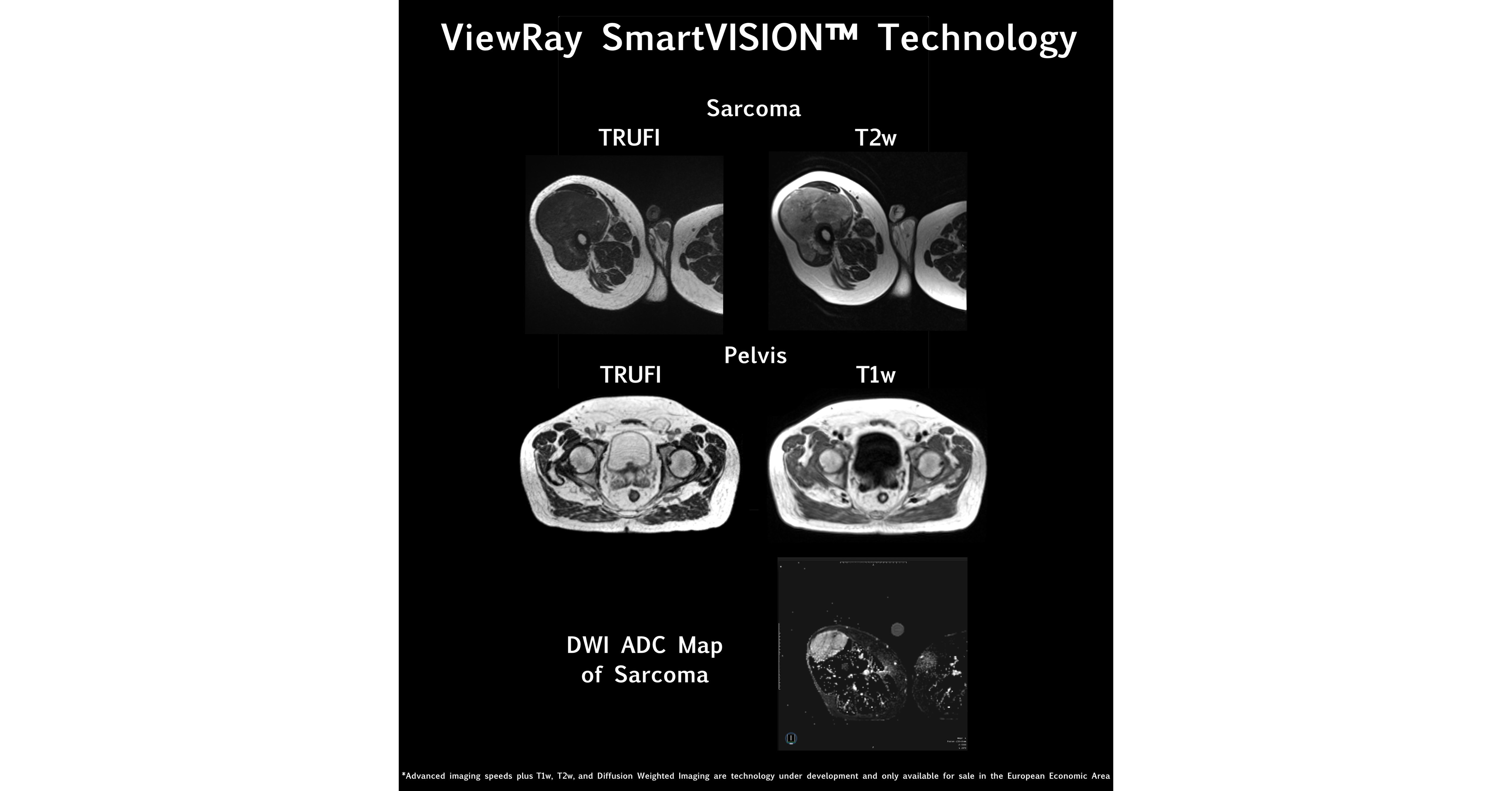 ViewRay Unveils New Soft Tissue Visualization Technologies to Further ...