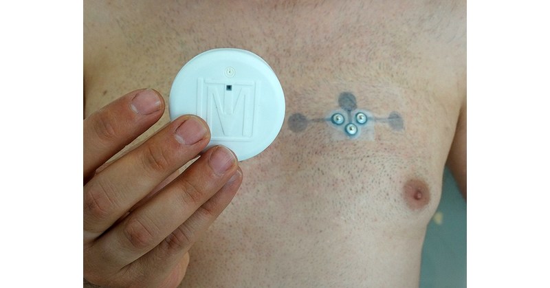 Smart Tattoo Sensors Poised to Revolutionise Continuous Vital Signs ...