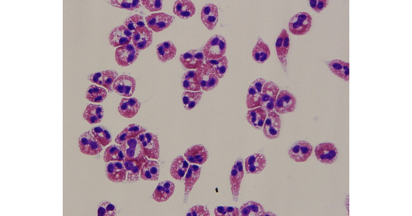 Discovery Could Lead To Personalized Medical Therapies for Emerging New ...