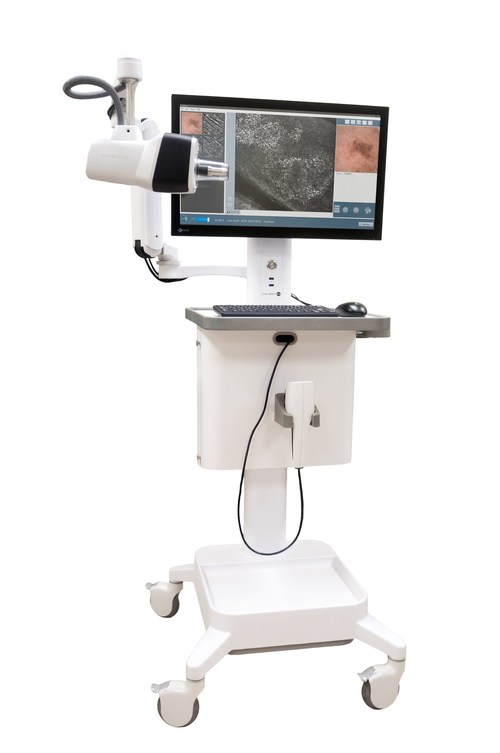 Caliber Imaging & Diagnostics, Inc. releases its latest VIVASCOPE 1500 ...