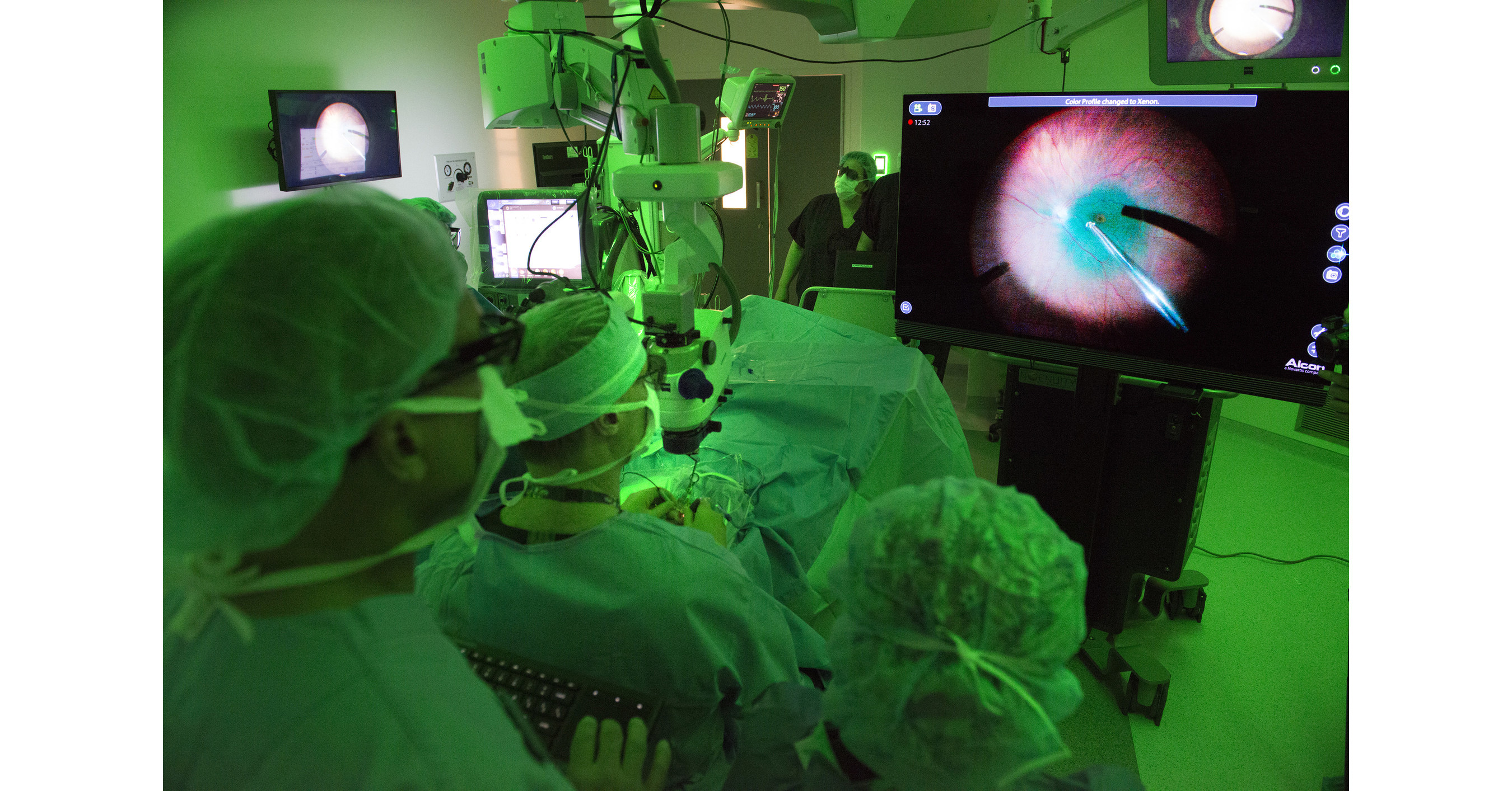 Le CHUM innove : voir l'œil en 3D pour mieux l'opérer