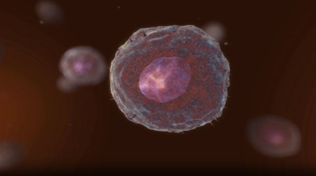 Les cellules tumorales circulantes vont permettre de stadifier le ...