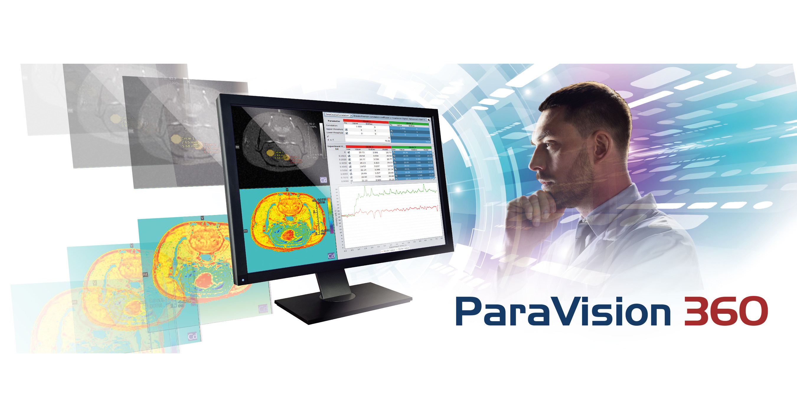 Bruker Introduces ParaVision® 360 Preclinical Imaging Software and ...