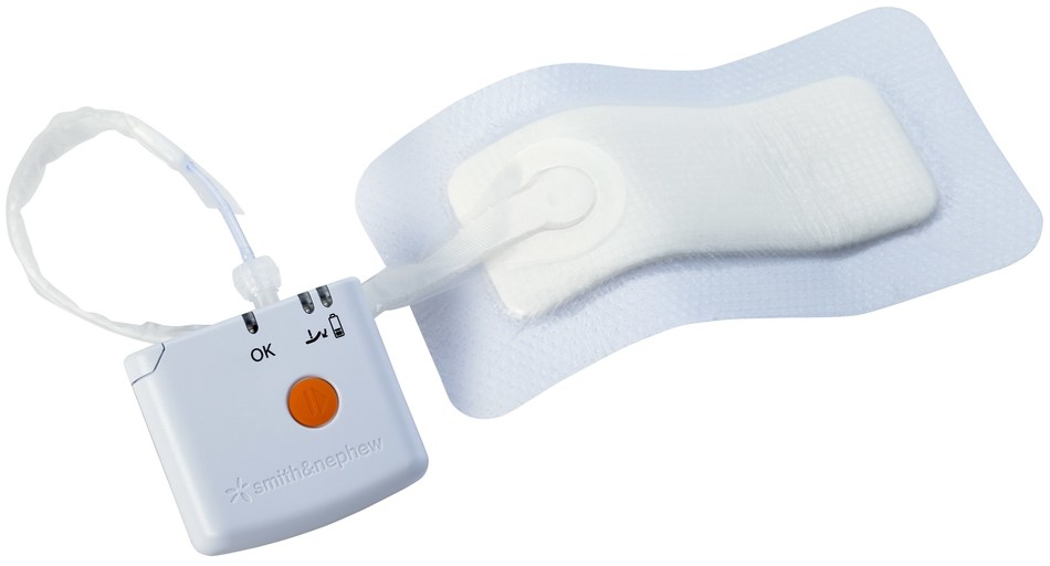 UK’s NICE Publishes a Medtech Innovation Briefing on PICO™ for the ...