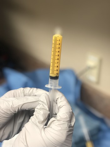 FDA Clears The Way: Lipogems' Receives FDA Clearance For ...