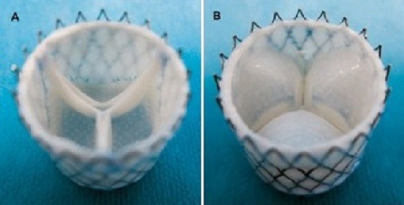 IDTechEx Research: Long Term In Vivo Performance of Tissue Engineered ...