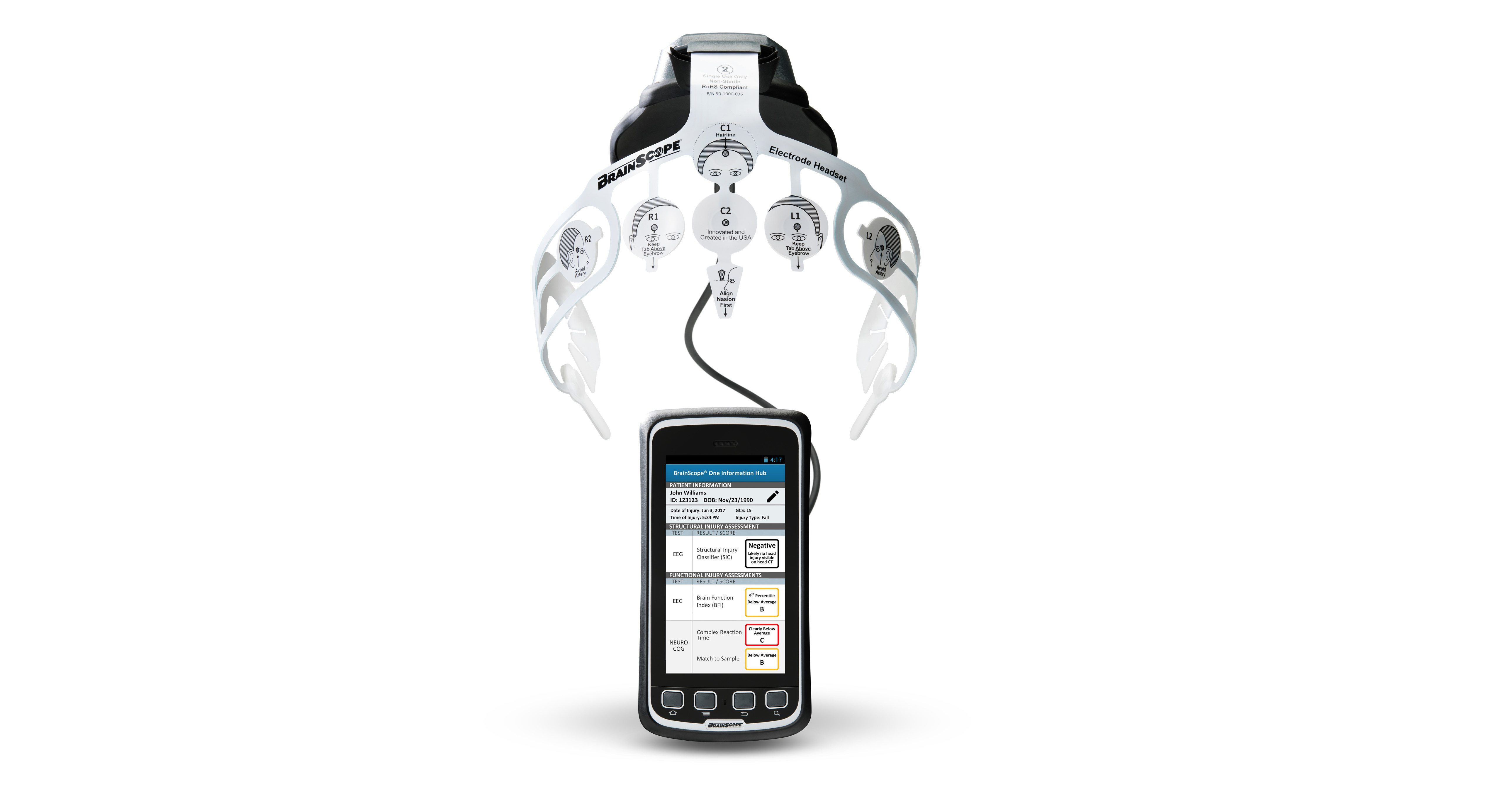 Grady First Georgia Hospital to Use BrainScope