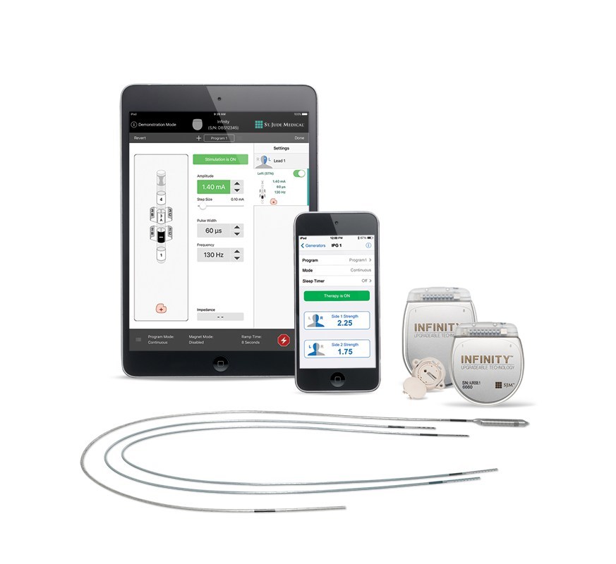 Abbott Expands its Directional Deep Brain Stimulation Therapy by ...