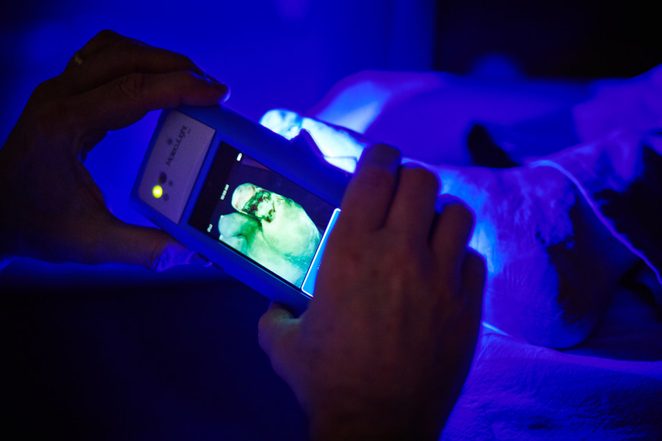 MolecuLight® Inc.'s first-of-its-kind handheld fluorescence imaging ...