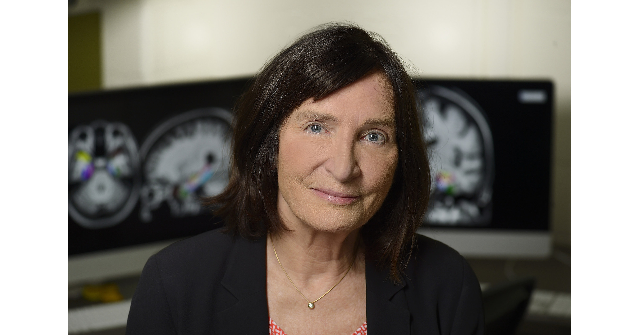 Dr. Michela Gallagher Wins Alzheimer's Drug Discovery Foundation's ...