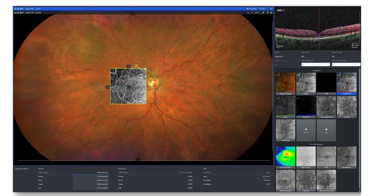 ZEISS Presents Integrated Data-Driven Digital Solutions at ESCRS ...