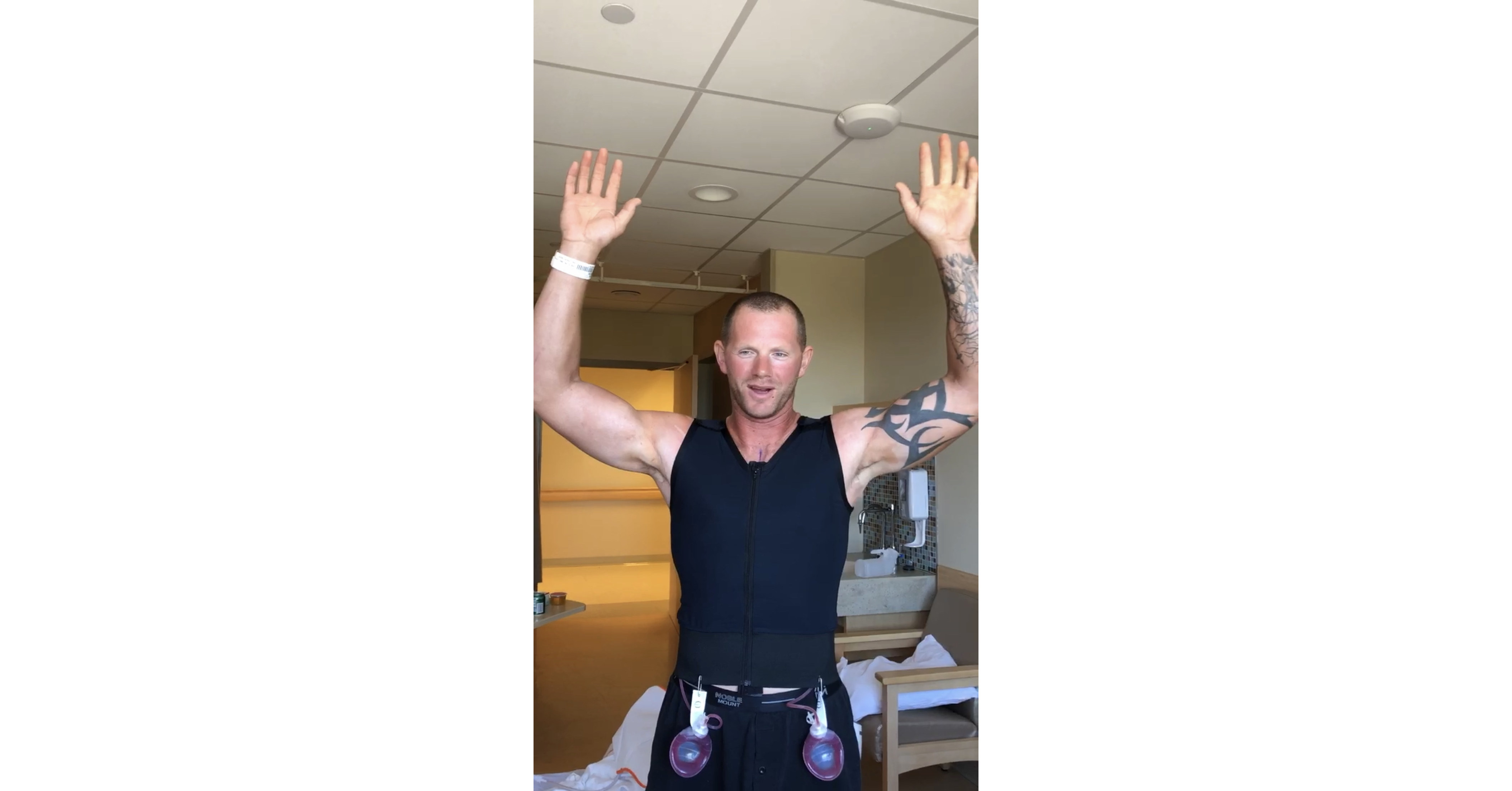 First Male Robotic Mastectomy Worldwide Performed by Dr. Stephen A ...