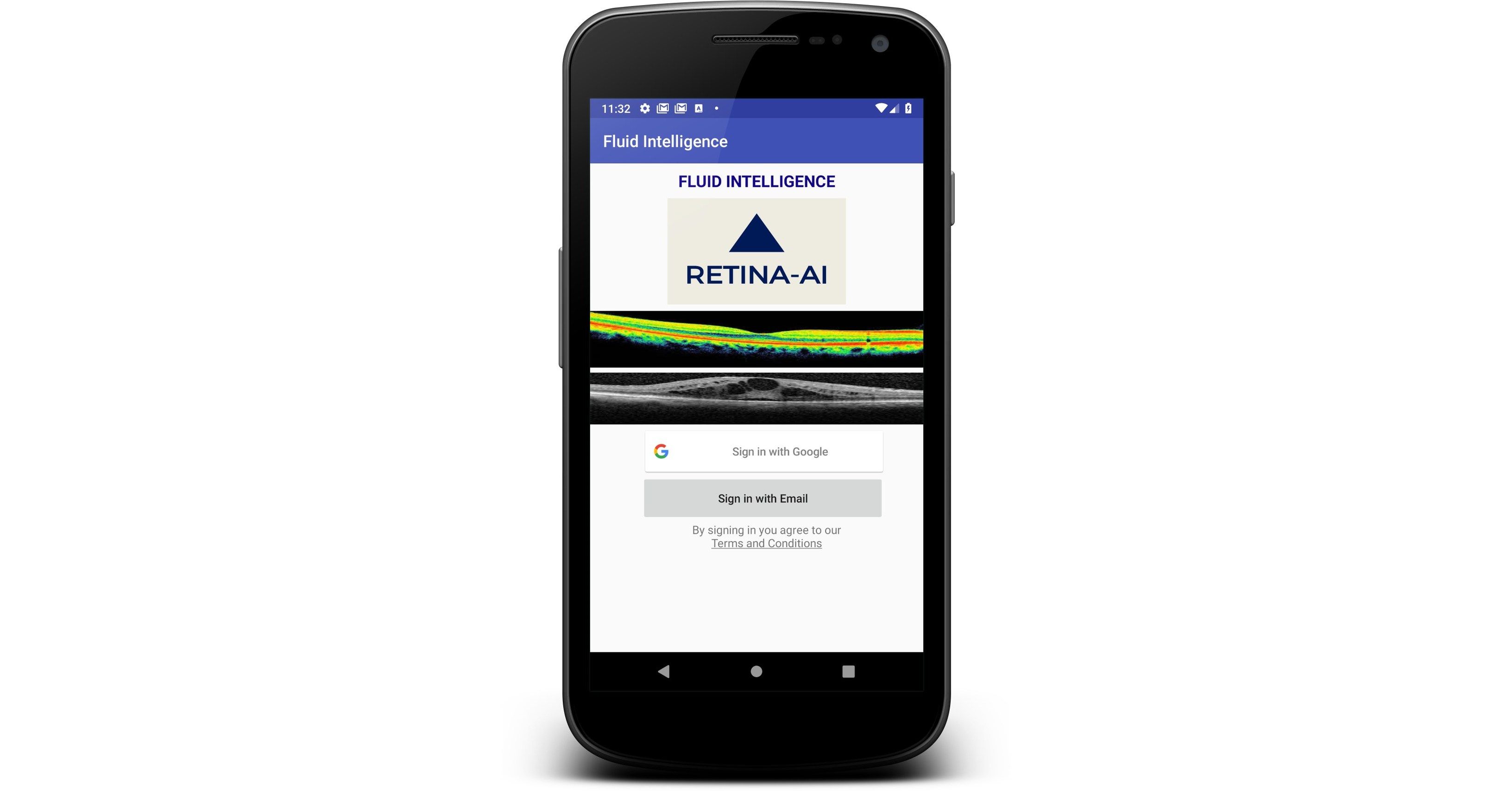 RETINA-AI Releases Android Version of Fluid-Intelligence -- World's ...