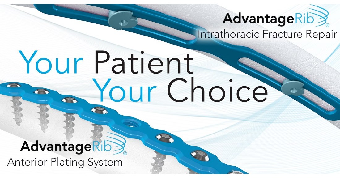 FDA Clears SIG Medical's AdvantageRib Anterior System