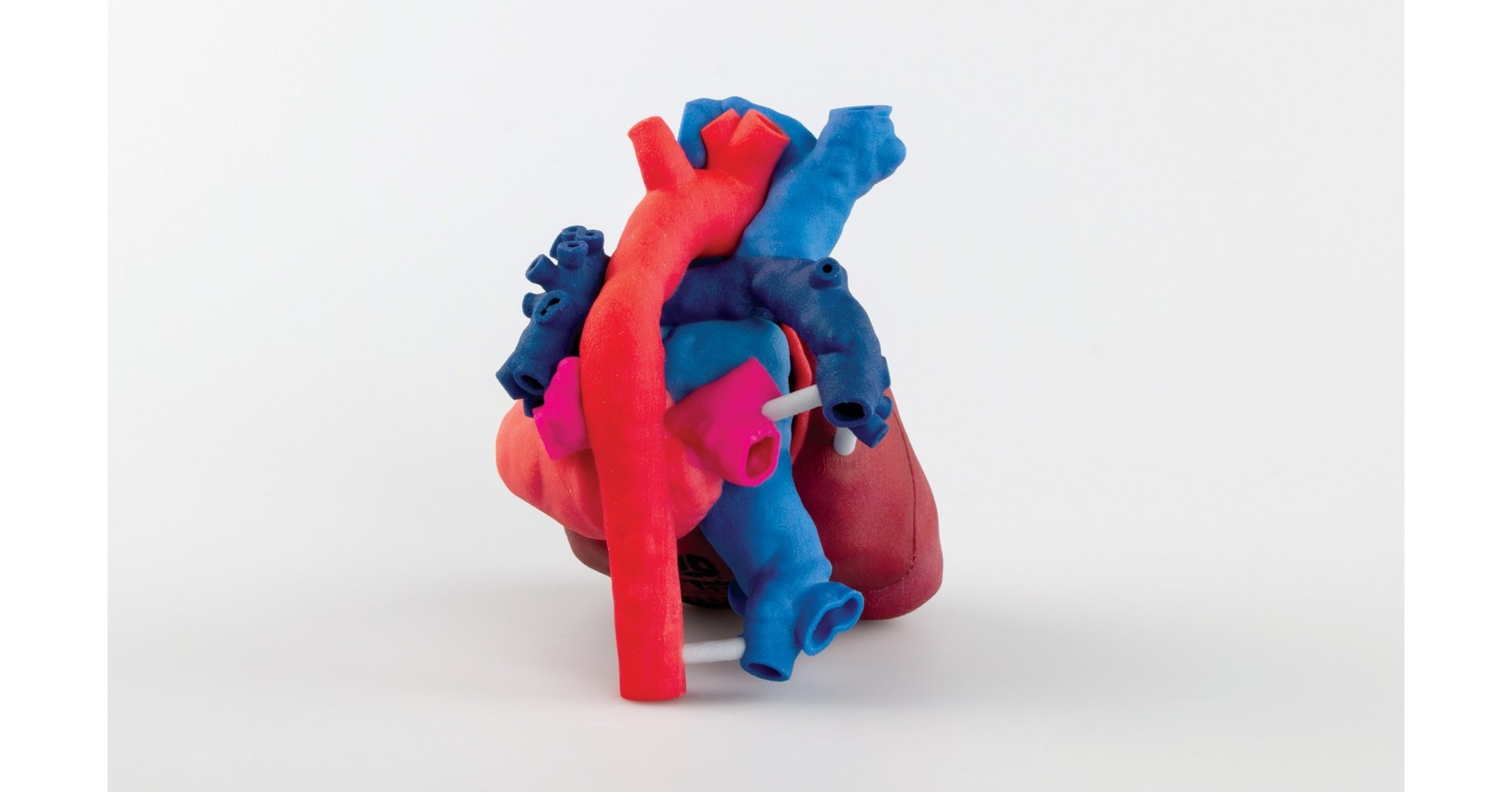3D Systems' Medical Workflow Enables OpHeart's Mission with 3D Printed ...