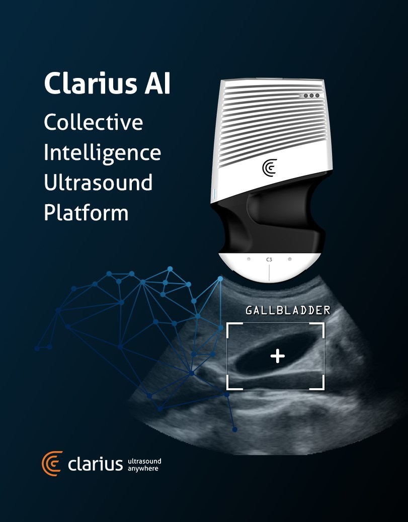 Clarius Mobile Health Announces Clarius AI: Collective Intelligence ...