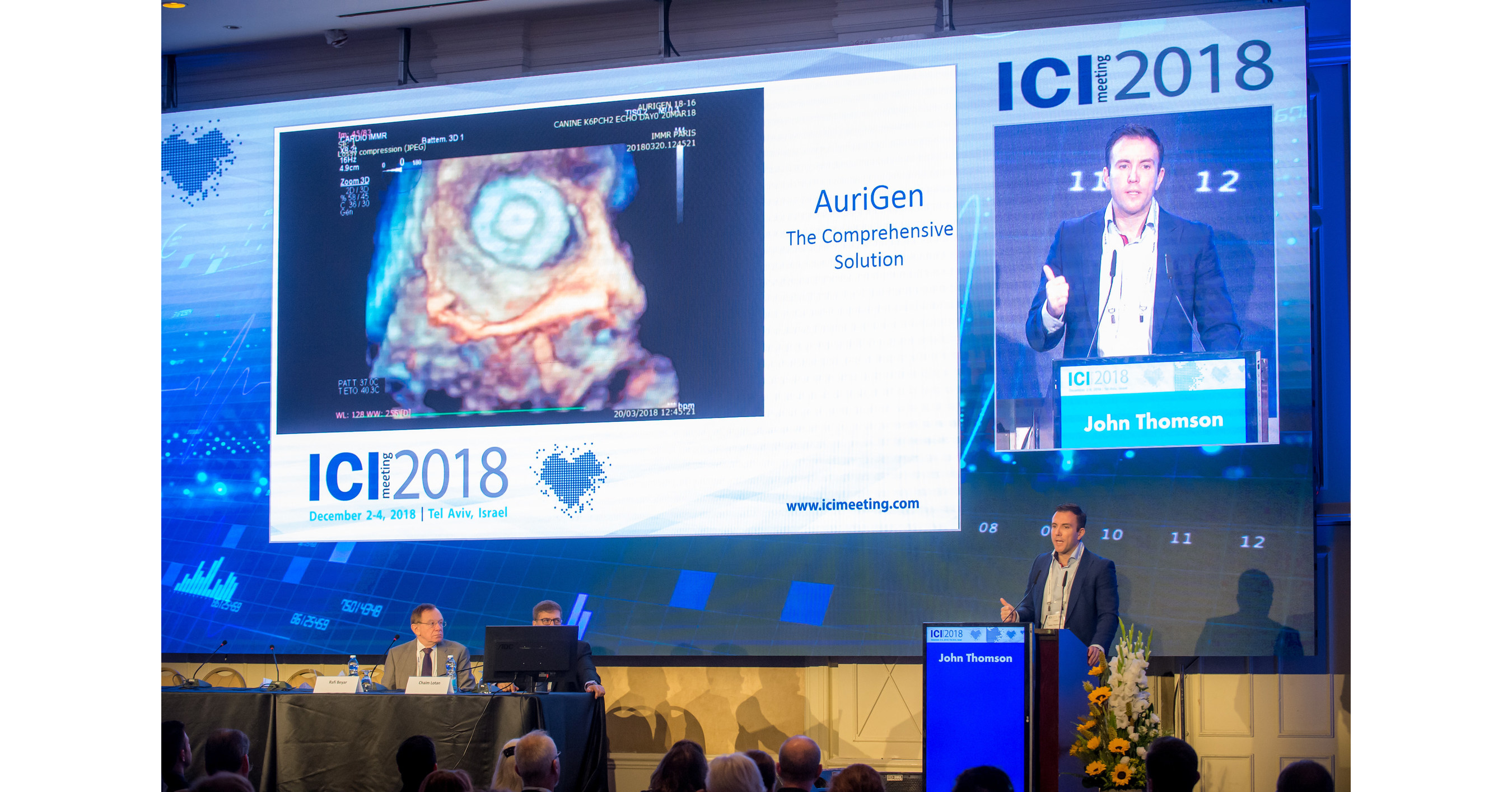 Irish Medical Device Start-up Curing Irregular Heart Rhythms Wins the ...