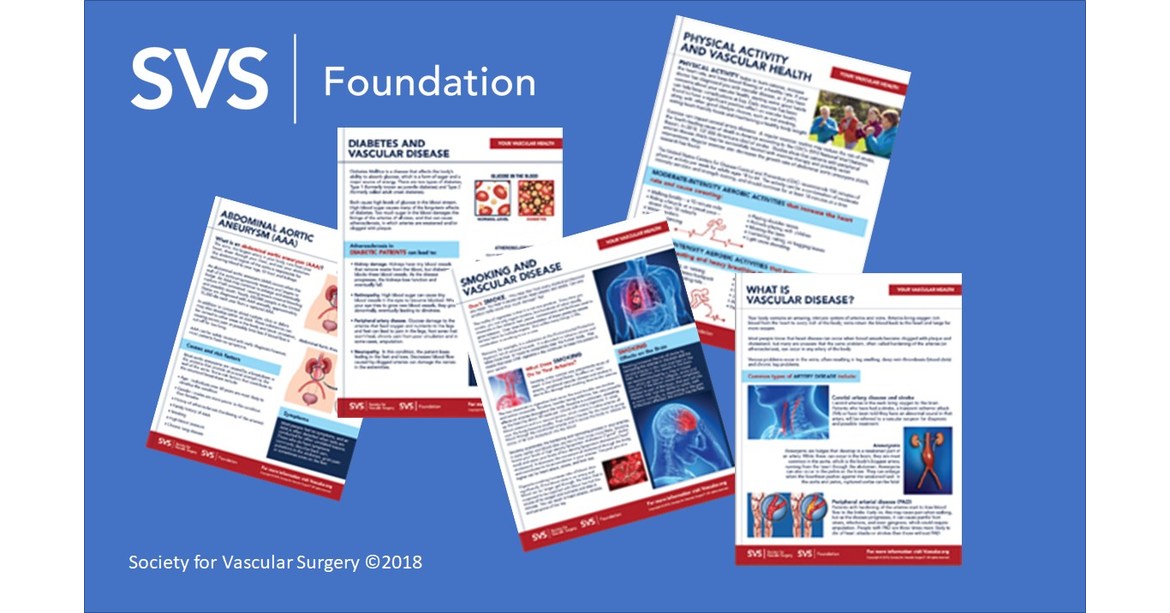 SVS Foundation: Be 'Circulation Smart' - Know what it takes to have a ...