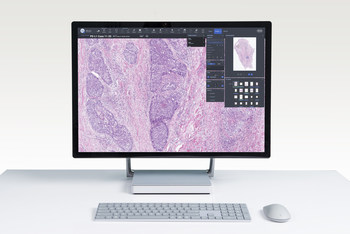 Roche launches uPath enterprise software with improved speed ...