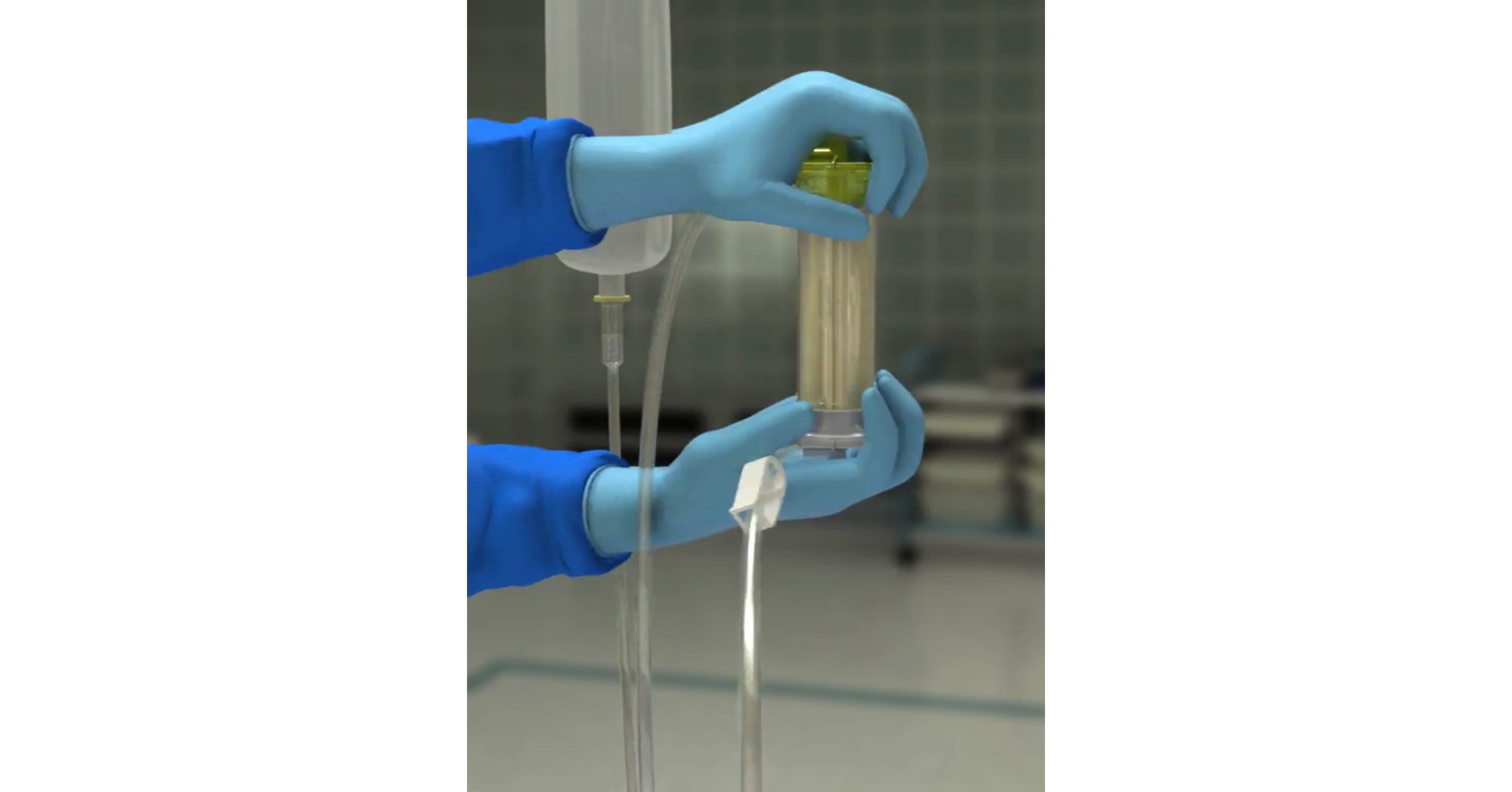 Duke University Doctor Finds New Ally in Orthopaedics: Fat Cells to ...