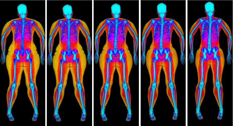 Bodyscan: 6,000 Scans Show Fat Mass Index (FMI) Is the True Measure of ...