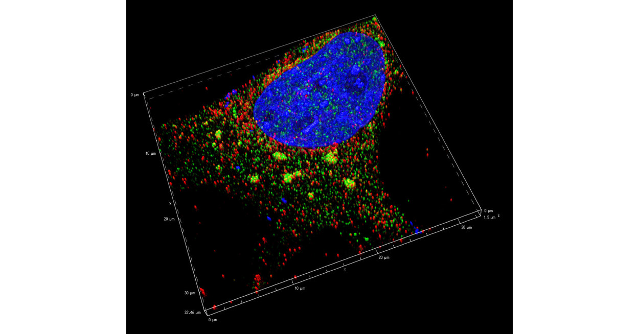Scientists Identify Gene that Keeps PTSD-like Behavior at Bay in Female ...