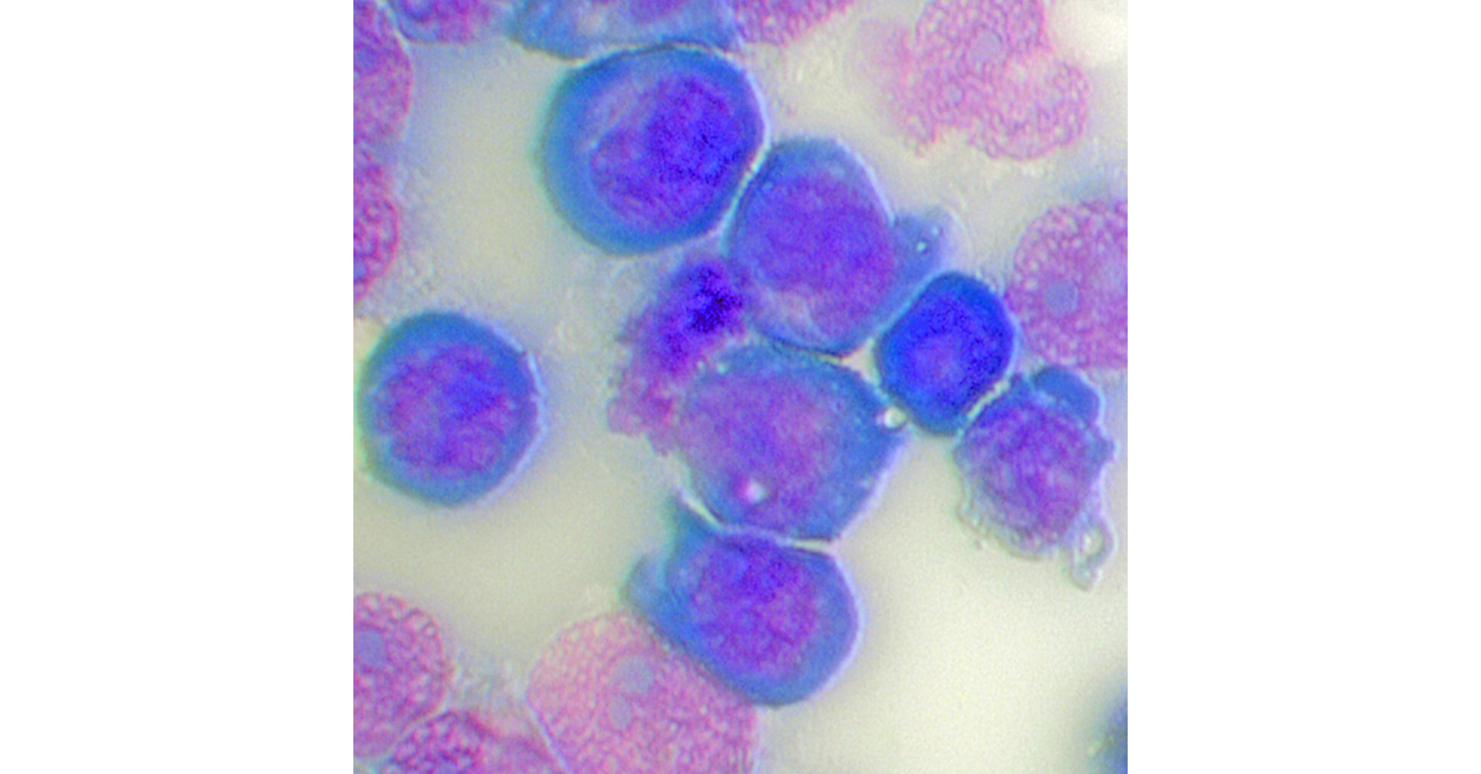 Overlooked Molecular Machine in Cell Nucleus May Hold Key to Treating ...