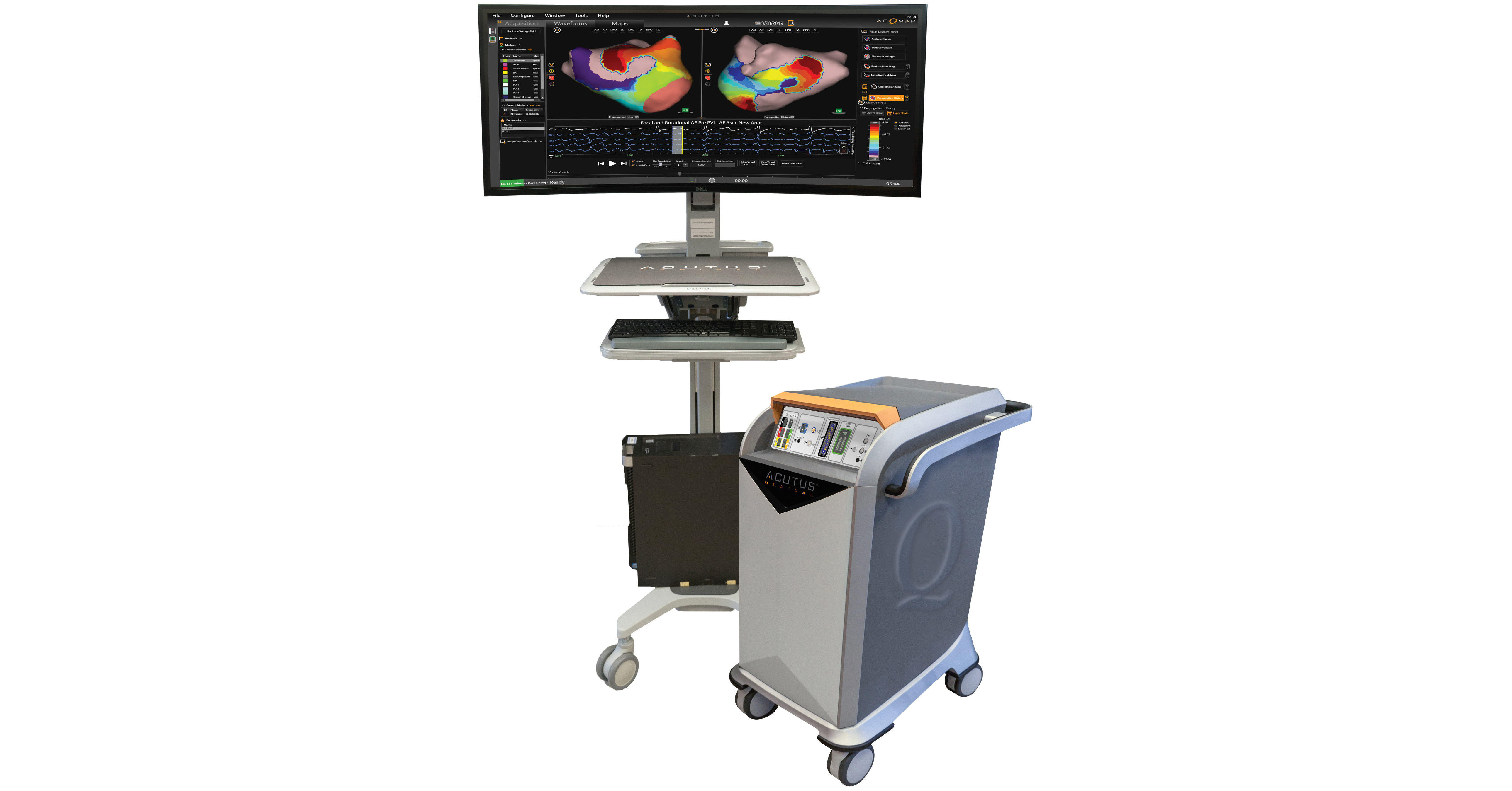 Acutus Medical's New Contact Mapping Software Receives CE Mark