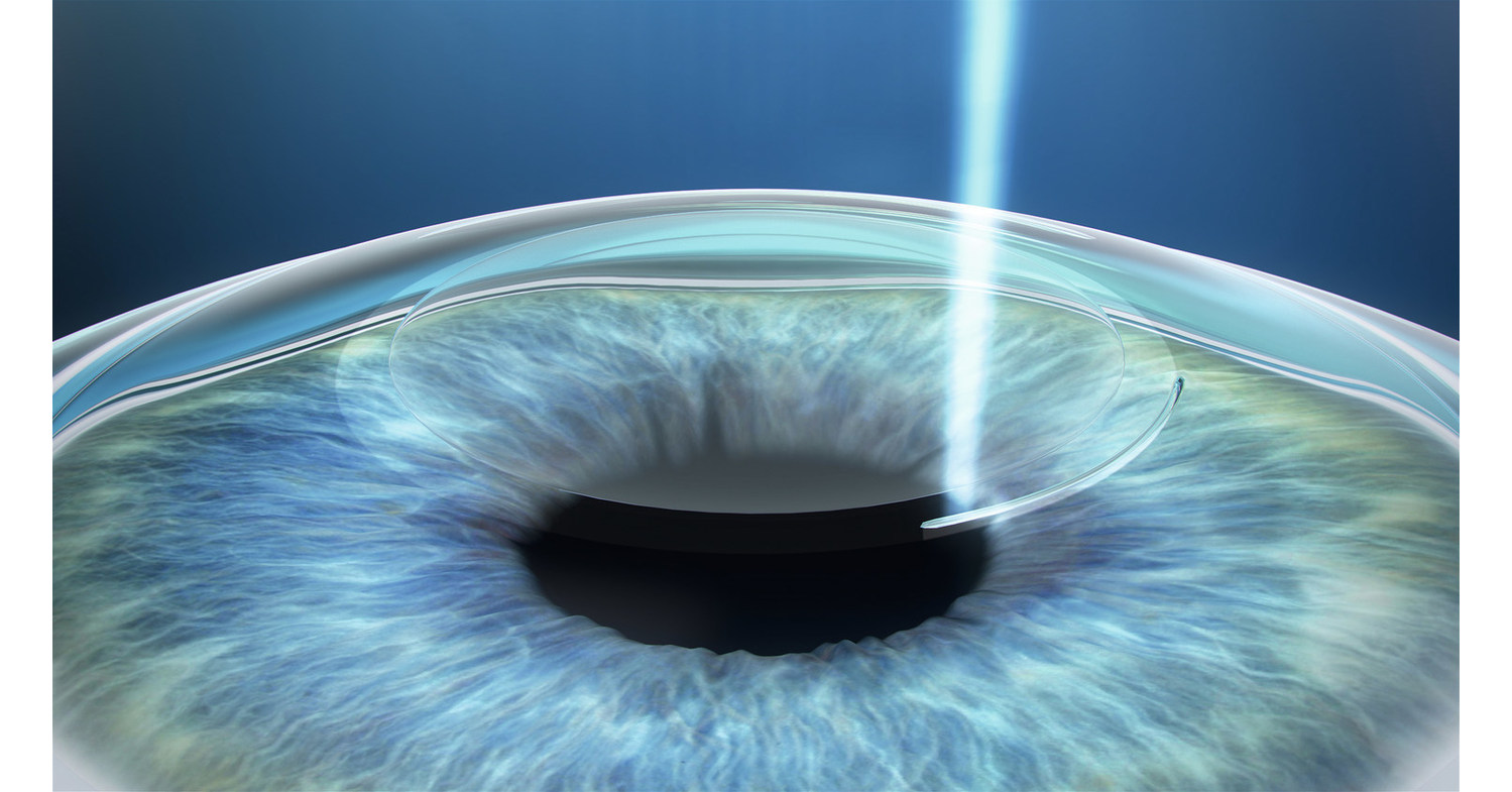 ZEISS announces new breakthroughs in digital technology and industry ...