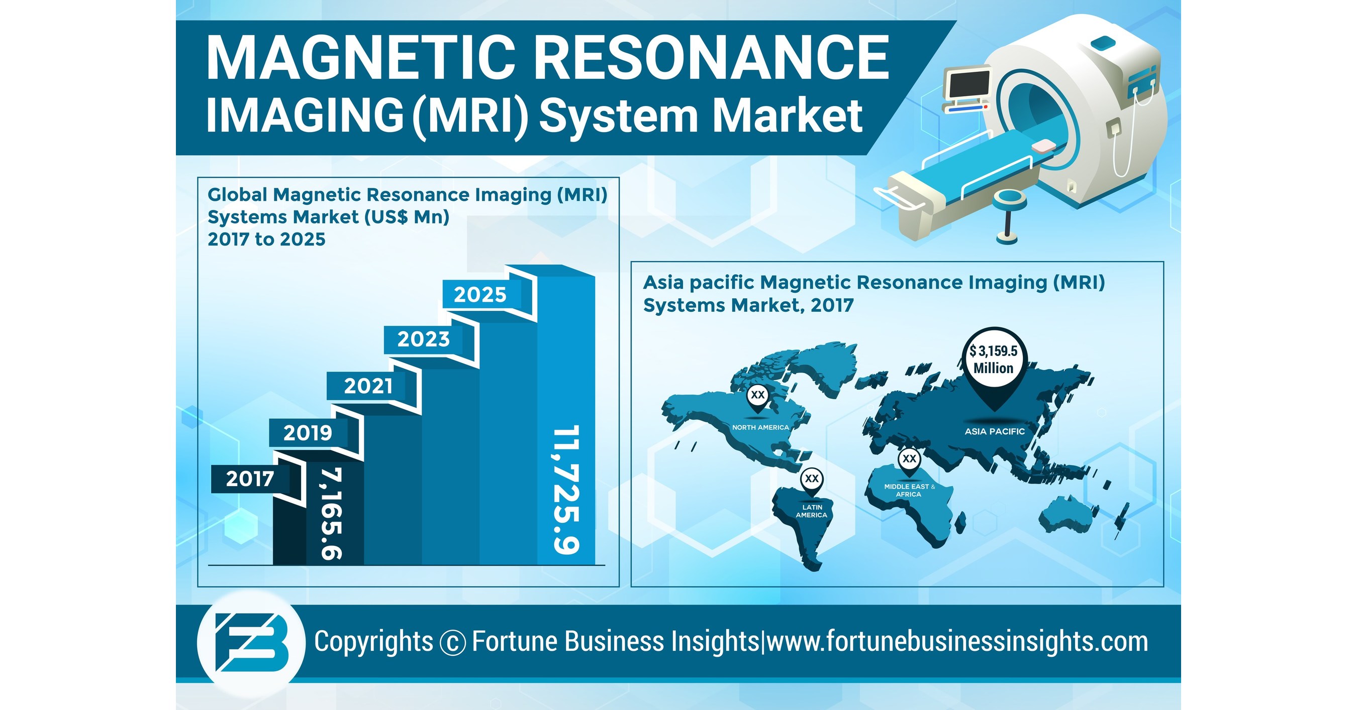 Magnetic Resonance Imaging (MRI) Systems Market Worth 11,725.9 Mn at 6. ...