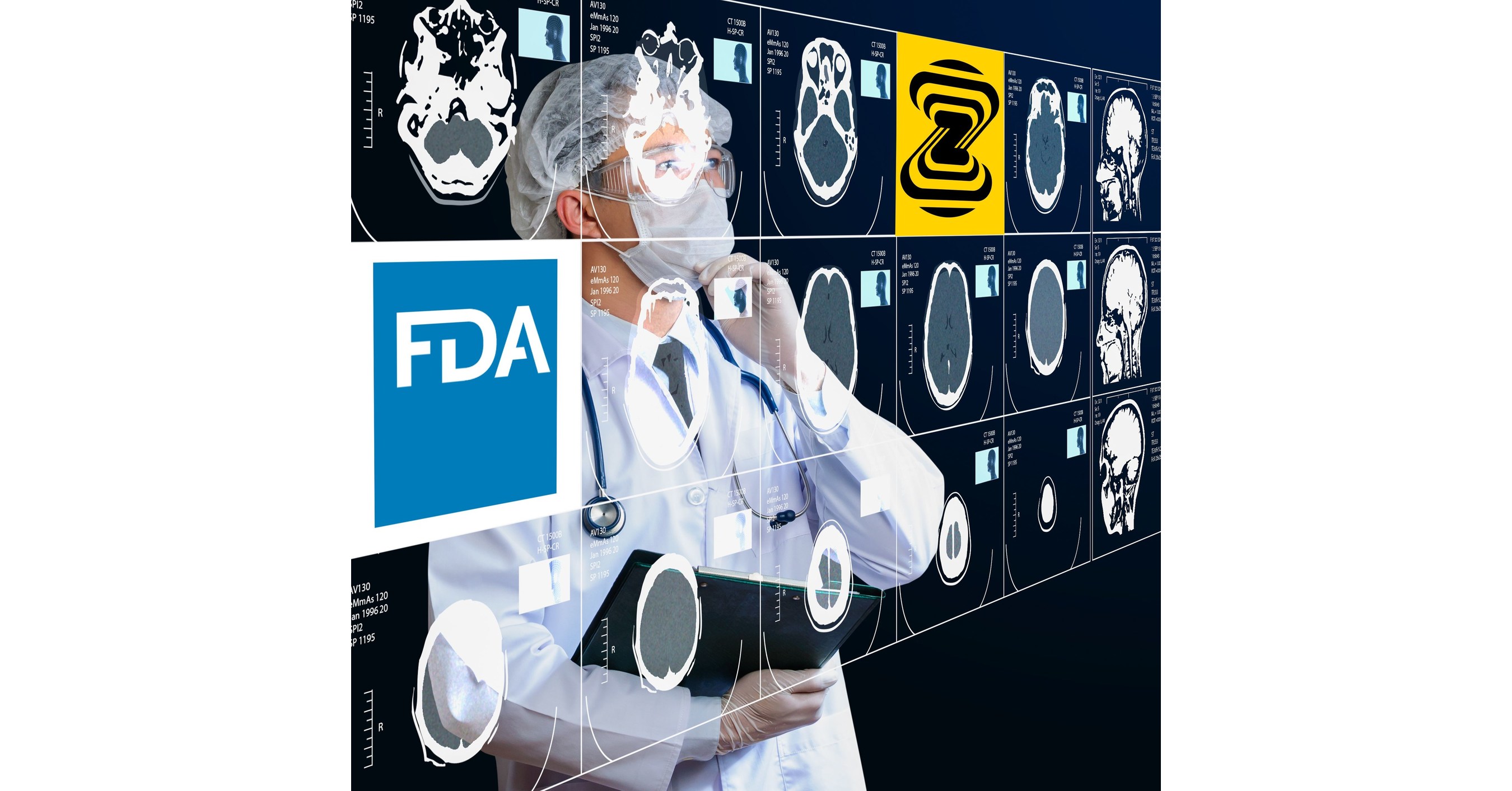 Zebra Medical Vision Receives FDA Approval for World's First AI Chest X ...