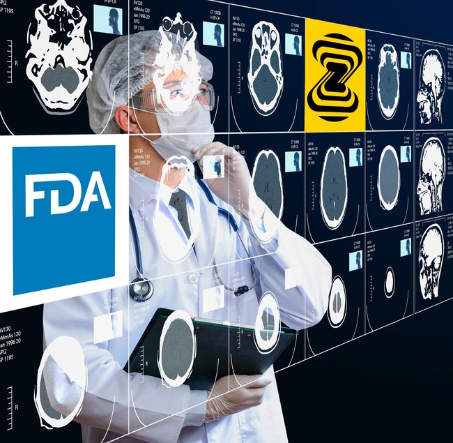 Zebra Medical Vision Receives FDA Approval for World's First AI Chest X ...