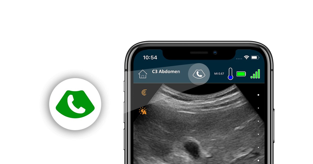 Clarius Simplifies Ultrasound Telemedicine with Latest Release