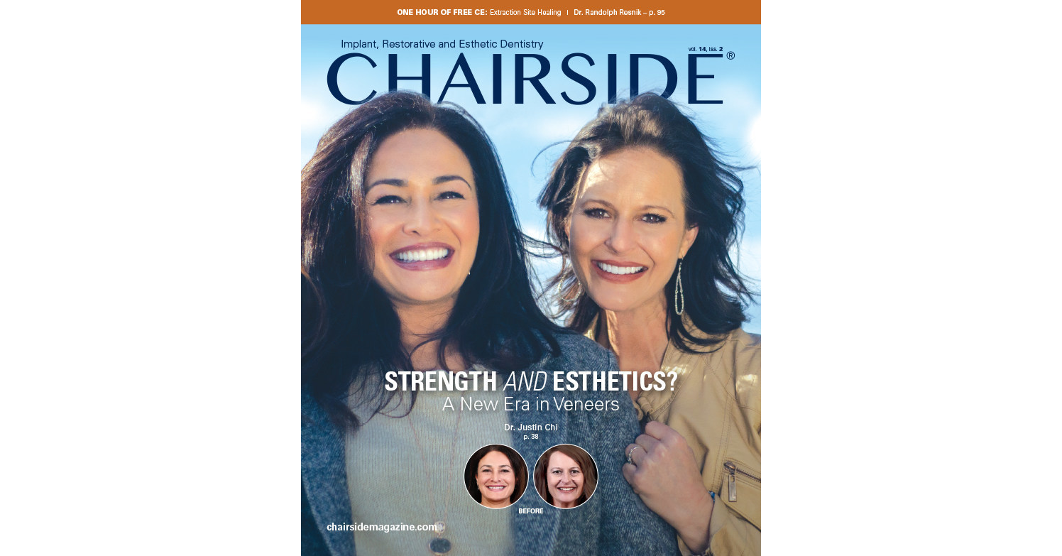 Latest Issue of Chairside Magazine Features Interview With Implant ...