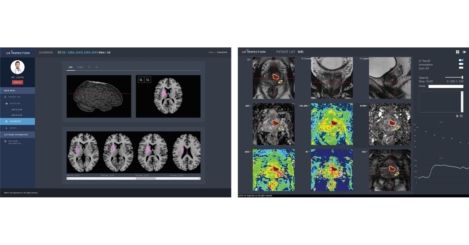CE Certification for AI-based Medical Solutions of JLK Inspection: AI-based Brain Image Analysis ...