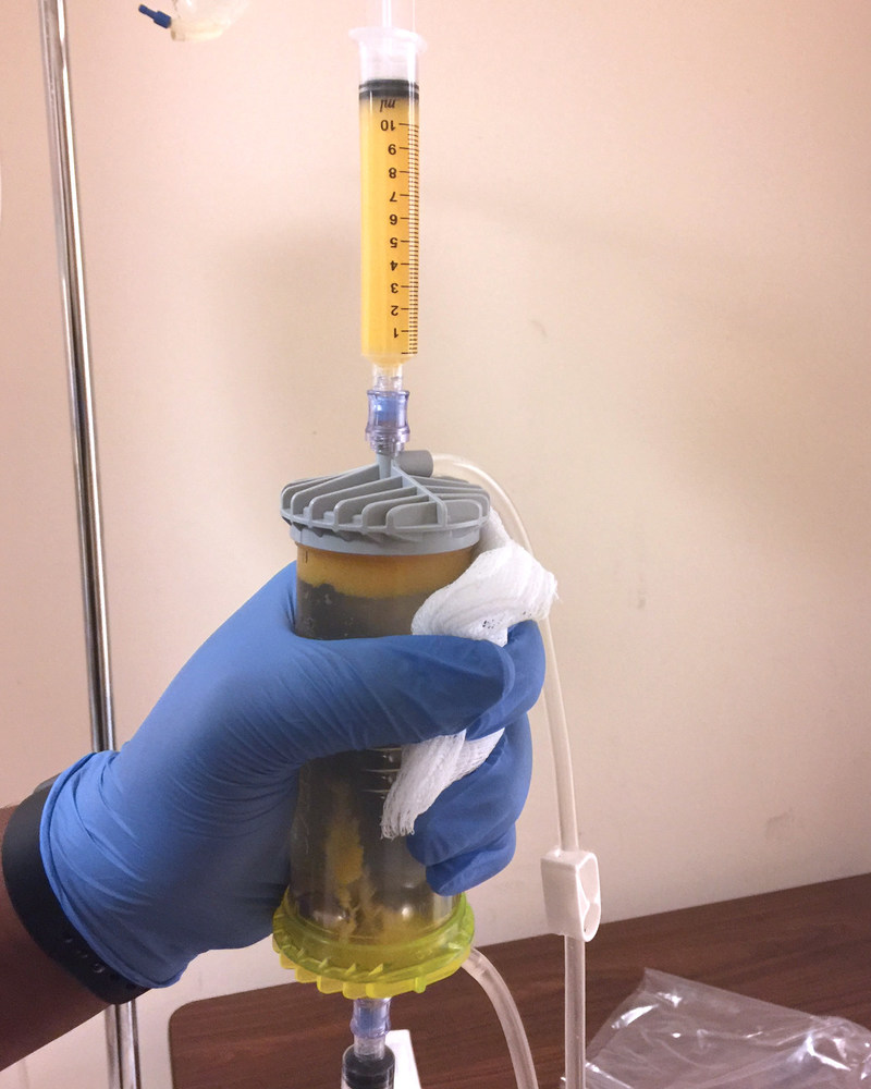 LIPOGEMS Announces Milestone of 35,000 Procedures Performed For ...