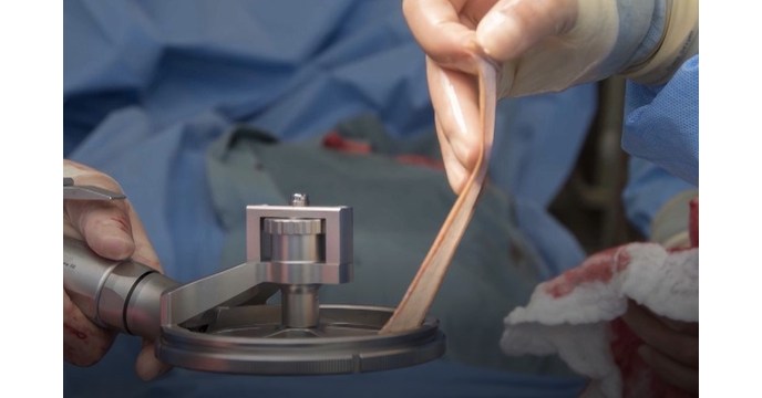 Exsurco Medical Announces Recently Published Peer Reviewed White Paper ...