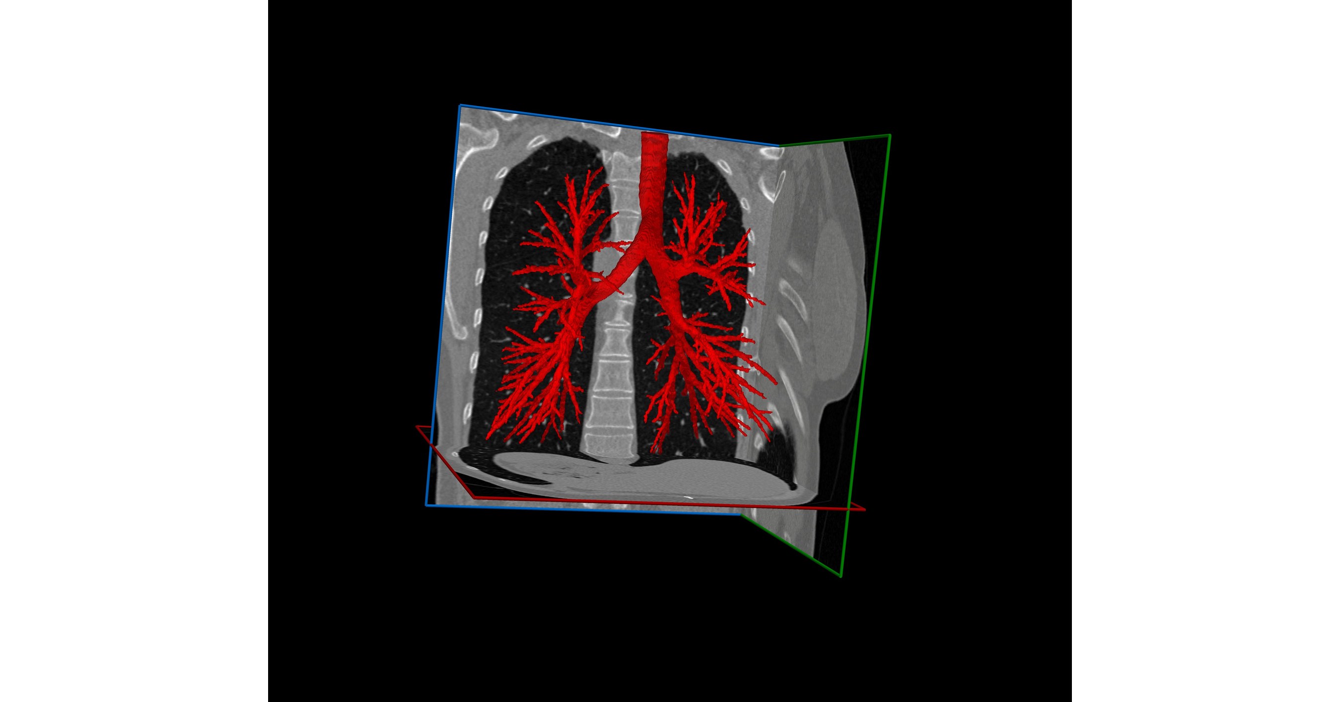 RSIP Vision's Advanced AI Technology Provides Segmentation with ...