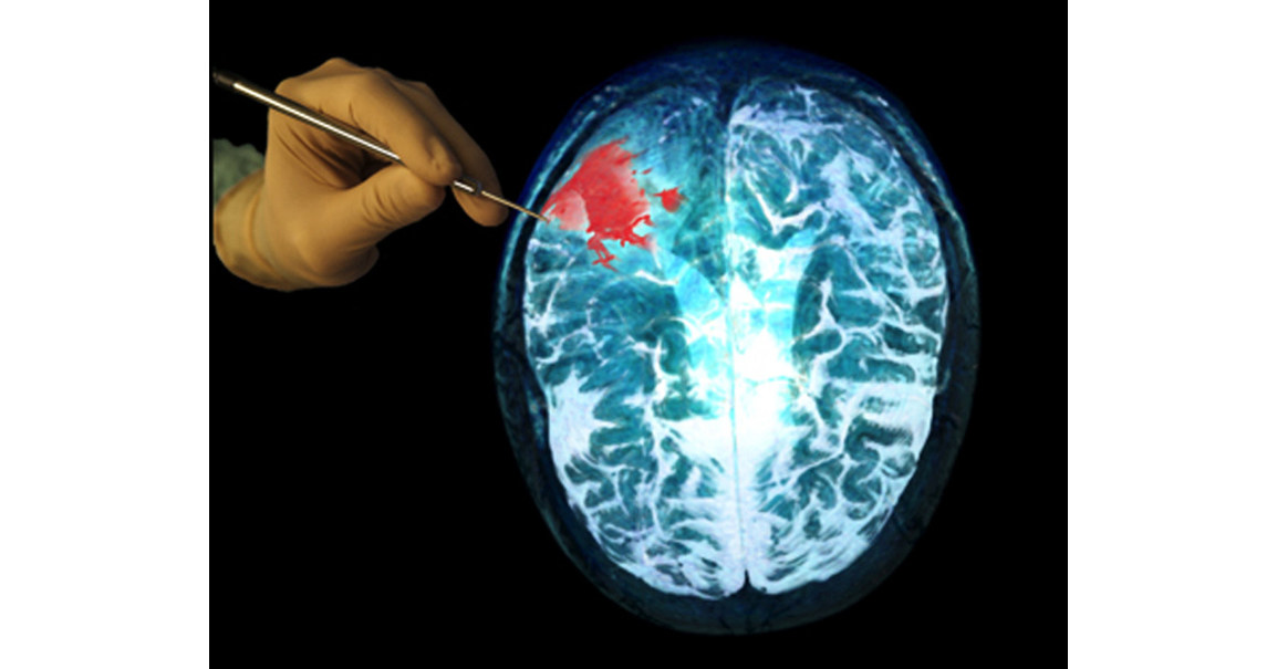 ODS Medical Inc. announces Sentry™ System prototype for real-time Raman ...