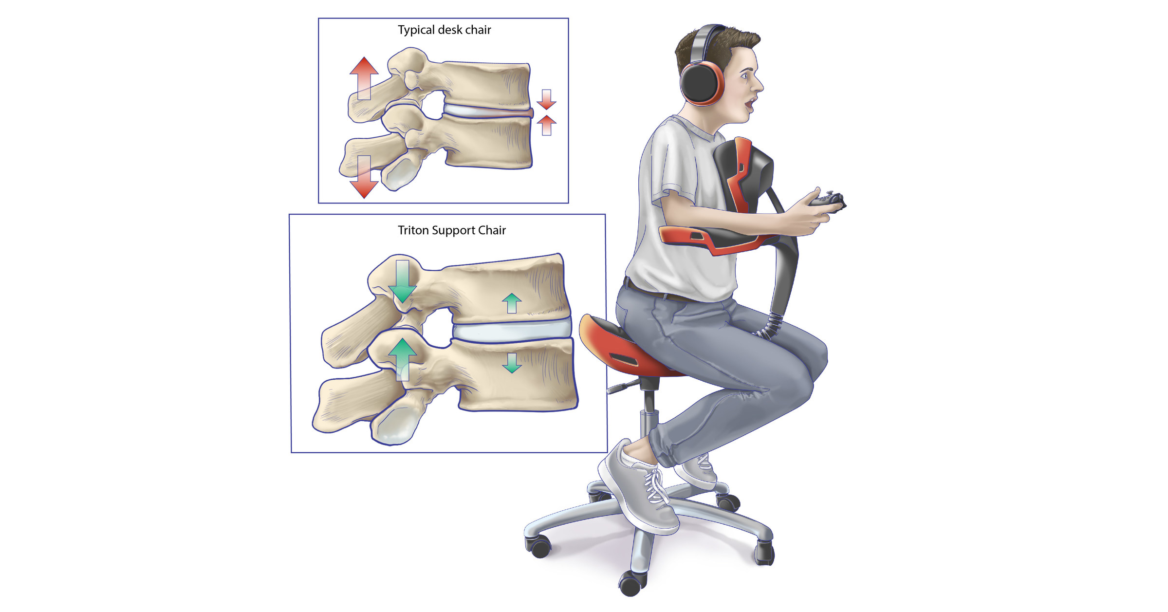 New Seating Design to Combat Back Pain