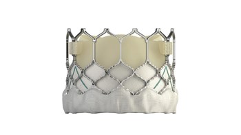 Edwards SAPIEN 3 TAVR Receives FDA Approval For Low-Risk Patients