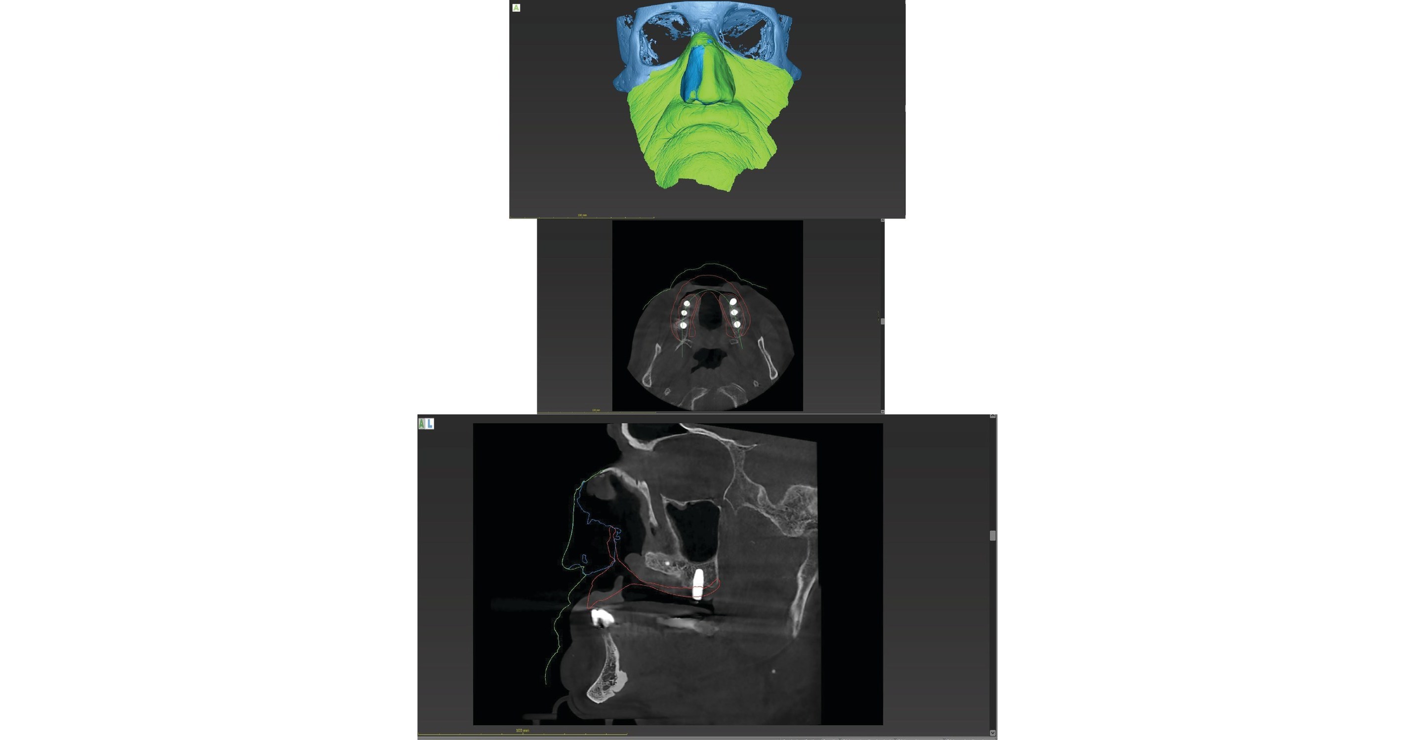 Groundbreaking Imaging Technology From HDX WILL Empowers Dental ...