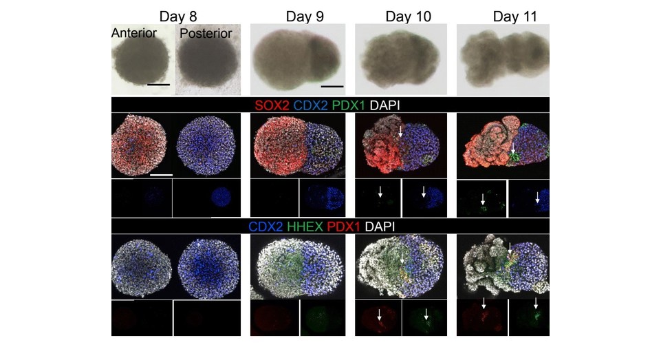 World's First Three-Organoid System Opens Doors for Medical Research ...